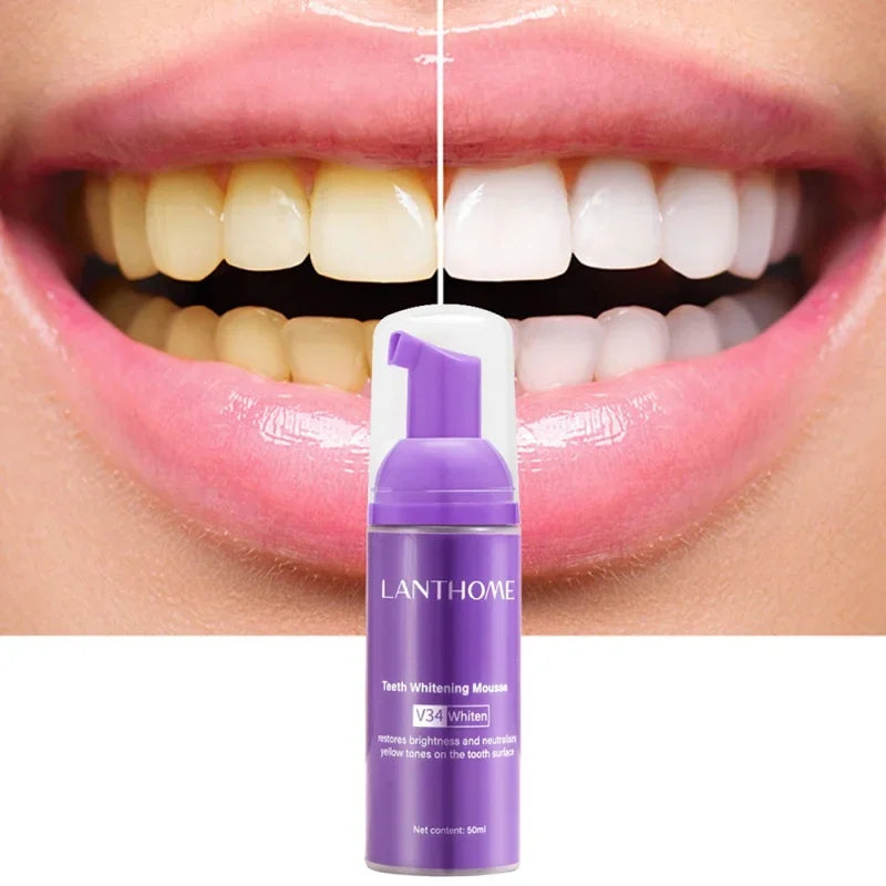 50ml Toothpaste Mousse V34 – Teeth Whitening & Stain Removal | Fresh ...