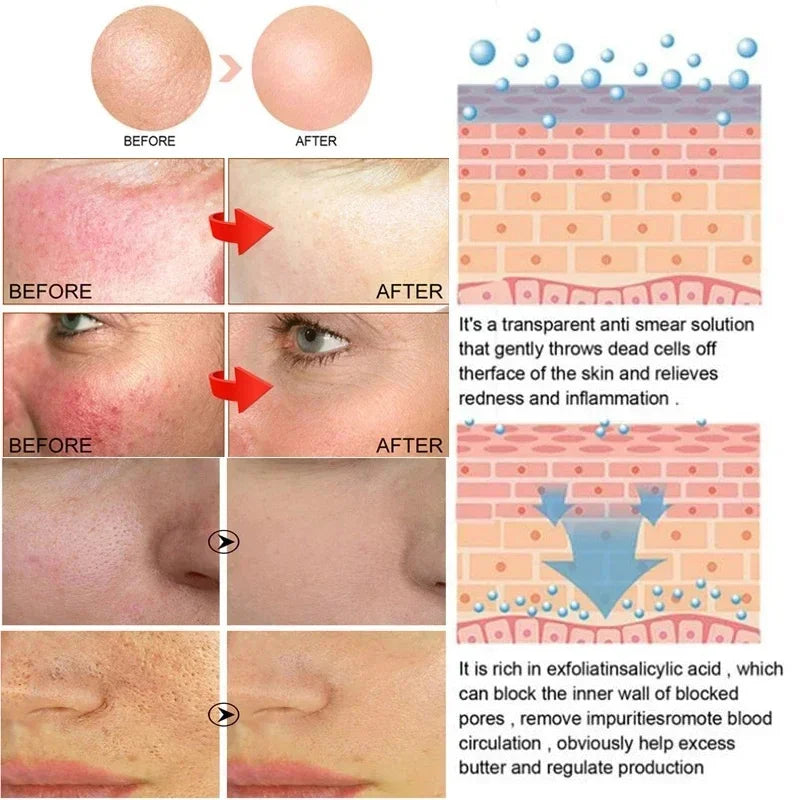 7X Facial Redness Soothing Serum – Instant Rosacea & Red Blood Vein ...