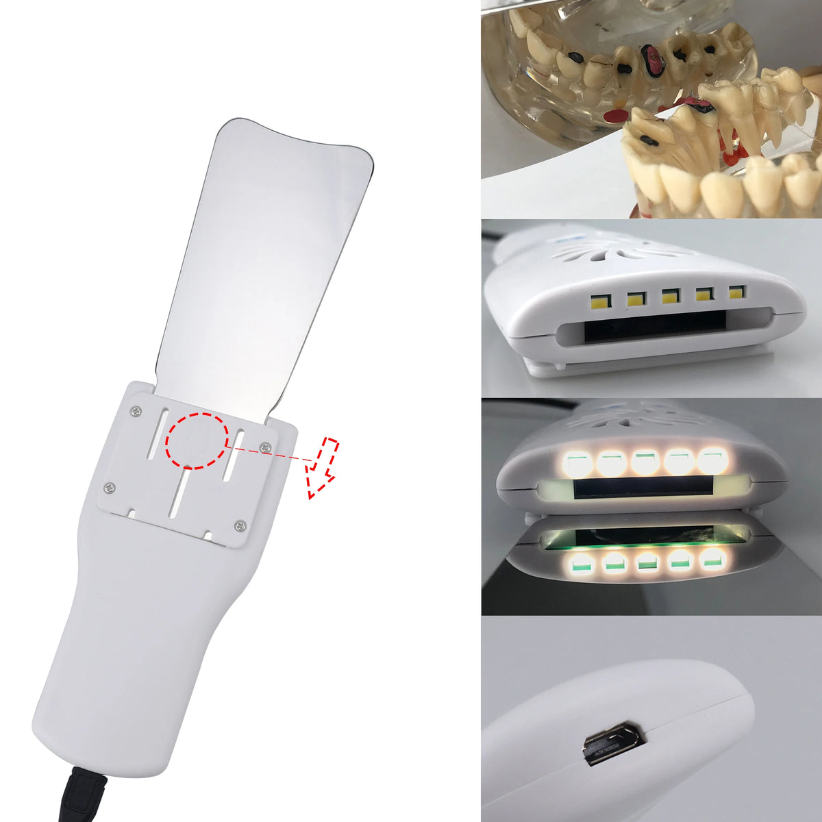 Dental Anti-Fog Mirror for Oral Photography | Orthodontic Occlusal ...